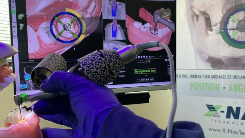 Computer Aided Dental Implant Systems - Farnham Dentistry Jacksonville